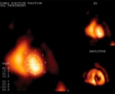 Home - Healthy Heart Institute